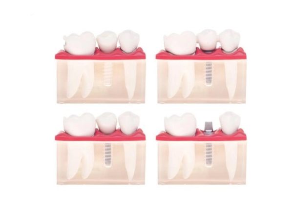 PVC Plastic Soft Gum Teeth Model , Dental Models For Teaching CE ISO ...